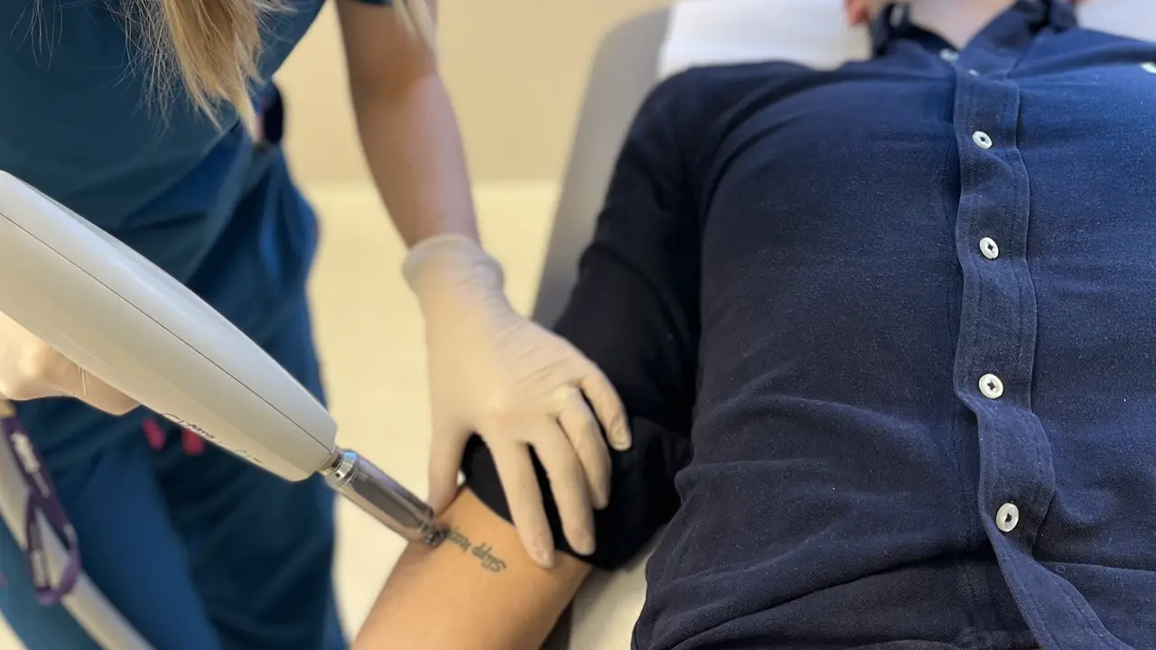 Fjerne tatovering med laser | Fornebuklinikken har topp moderne utstyr ...
